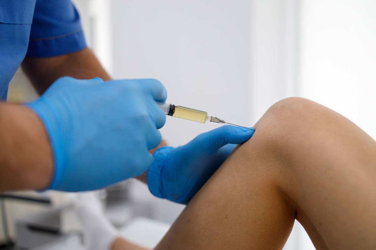 MVT (Microvascular Tissues Injection) in Thousand Oaks, CA | Cohen ...